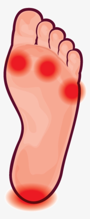 Callus - Callus Png - 600x600 PNG Download - PNGkit