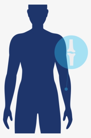 Bone Icon - Muscle Atrophy Icon - 345x519 PNG Download - PNGkit