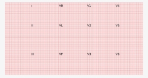 This Image Rendered As Png In Other Widths - Blank Ecg Paper - 500x266 ...