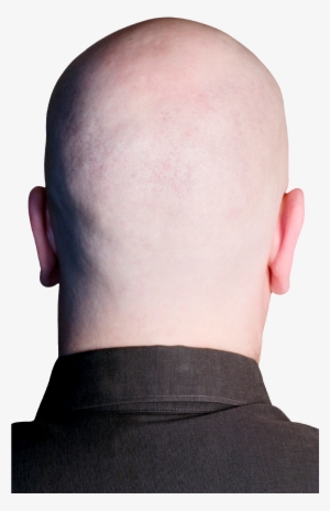 Bald Head Snapchat Filter - Bald Png - 400x400 PNG Download - PNGkit