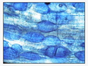 Vesicles In The Roots Of “tiben” Blackcurrant Shrubs - Painting ...