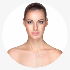 Freckles PNG, Free HD Freckles Transparent Image - PNGkit