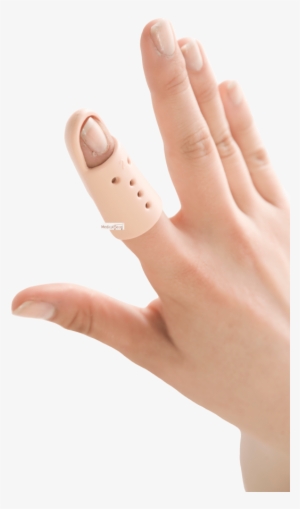 Doyle Classification Of Mallet Finger Injuries - Doyle Classification ...
