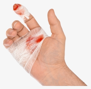 Steel Doctor Blade Injury Cut - Hand Blood - 4476x3577 PNG Download ...