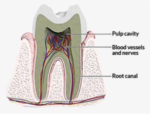 A Root Canal Is A Hollow Area Inside Your Tooth That - Fogfájás ...
