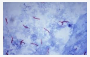 Prepared Slides, Mycobas, Tuberculosis Smear, Pk/50 - Sputum Afb ...