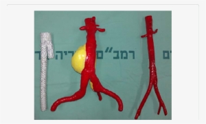 3d Models In Evar Planning - Endovascular Aneurysm Repair - 761x458 PNG ...