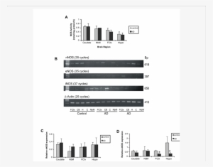 Pattern Of Nos Expression In Tissue Lysates Of Caudate, - Diagram ...