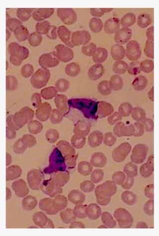 Blood Smear PNG, Free HD Blood Smear Transparent Image - PNGkit