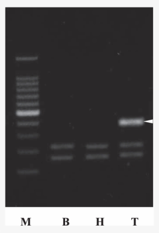 Restriction Pattern Of Haeiii Digested Ribosomal Rna - 675x731 PNG ...
