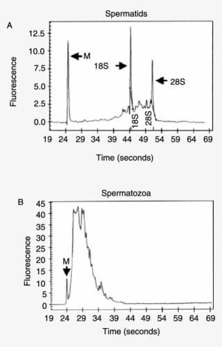 Total Rna Microelectrophoretic Profiles Of Spermatids - Diagram ...
