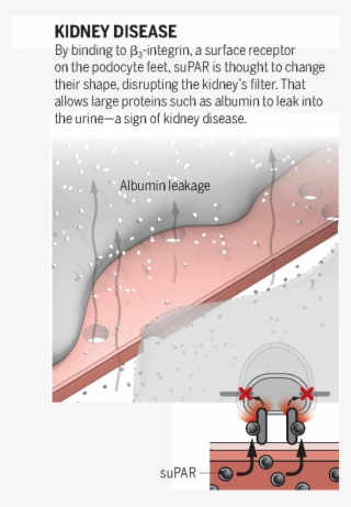 Supar And Kidney Disease - Diagram - 750x1000 PNG Download - PNGkit