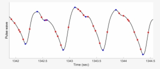 Illustration Of A Blood Pulse Wave As Seen From The - Plot - 1024x480 ...