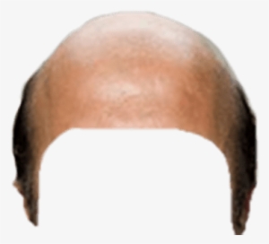 Bald Head Snapchat Filter - Bald Png - 400x400 PNG Download - PNGkit